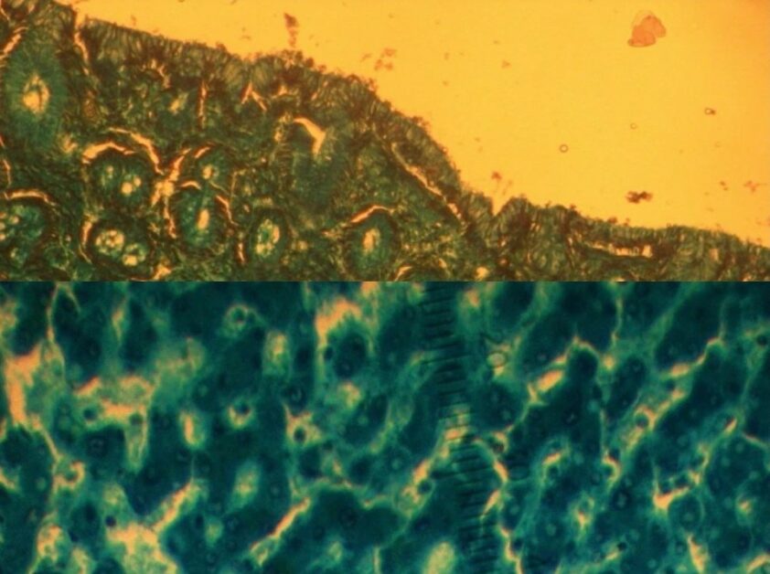 鑑識故事系列：如何「染出」內臟的鐵？ - PanSci 泛科學